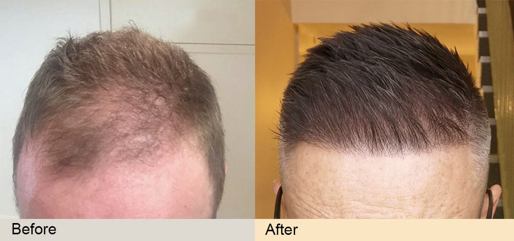 Dr Bonaros, Glasgow, UK